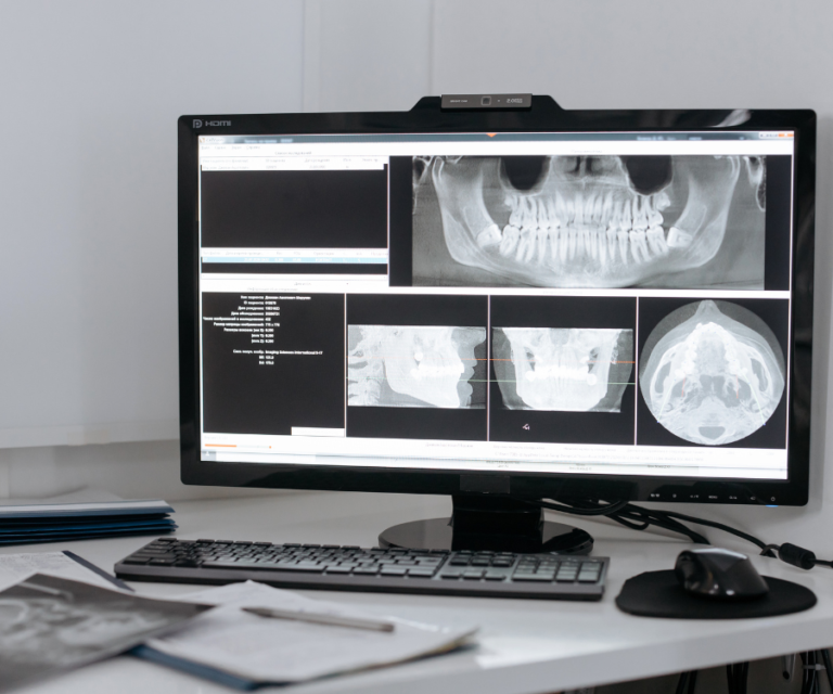 Digital X-Rays vs. Traditional Film X-Rays – SK Radiology