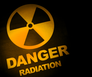 Are X-Rays Safe? Understanding Radiation Risks and Benefits – SK Radiology