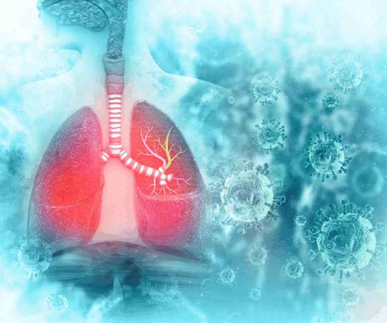 How X-rays help in detecting infections and lung diseases – SK Radiology